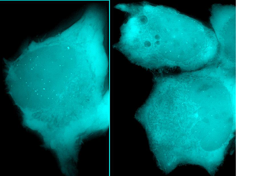 Première visualisation dynamique du virus du SIDA dans des cellules ...